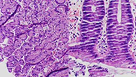 Technique – Induced Microtomy Artifacts | Lab Storage Systems, Inc.
