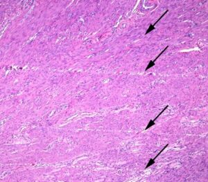 The Science & Mystery of Microtomy Part - 2 Troubleshooting | Lab ...